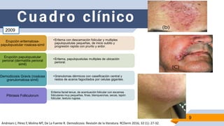 DEMODECIDOSIS MARIA ROCHA DERMATO.pptx
