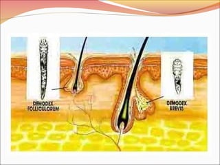 Demodex | PPT