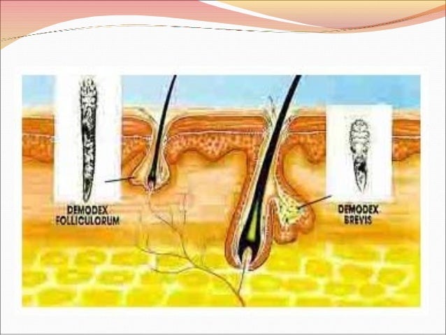 Demodex