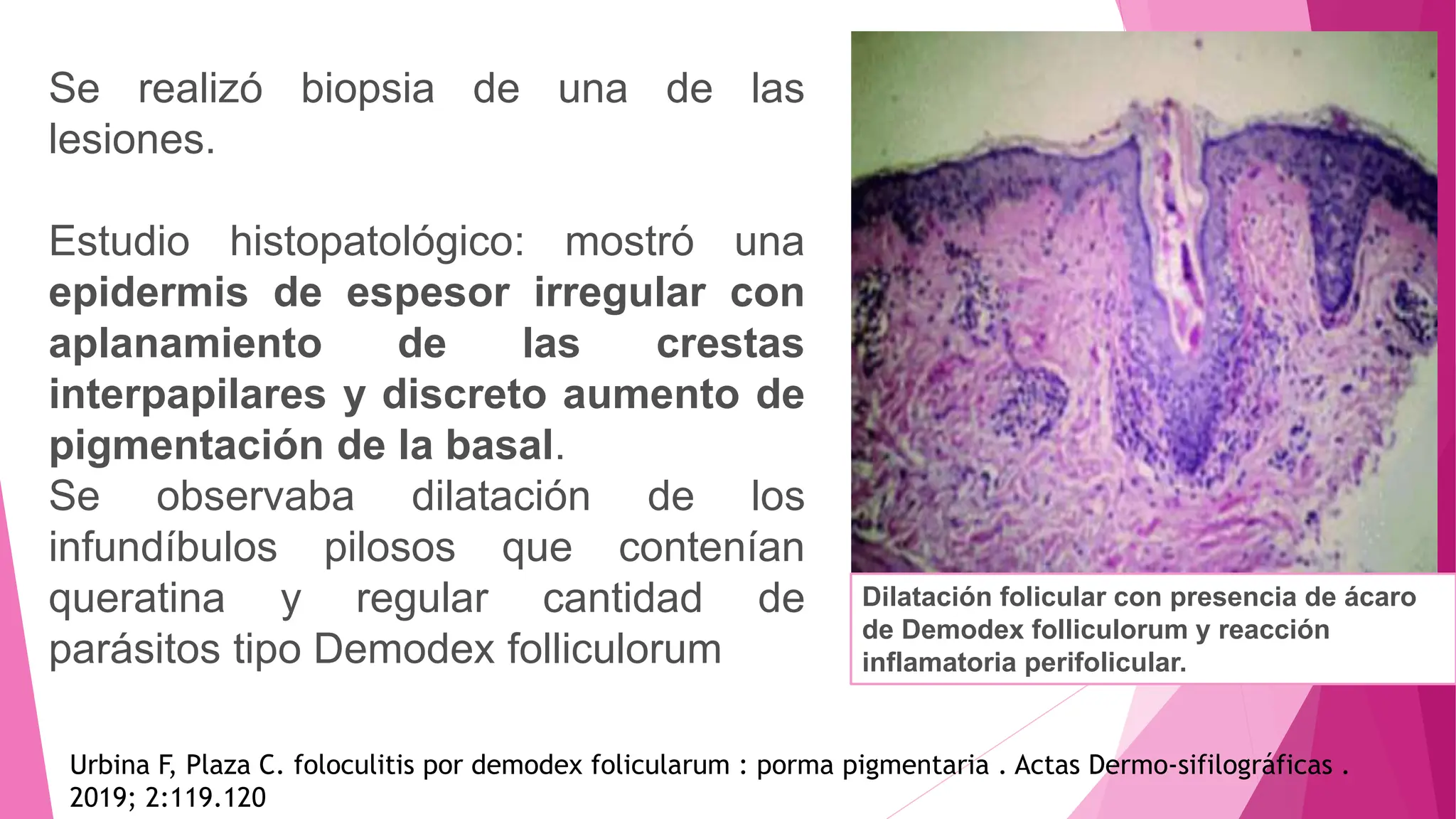 demodicosis, una patología poco frecuente. | PPT
