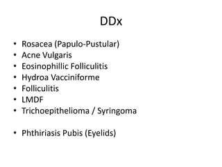 Demodex by aseem | PPTX