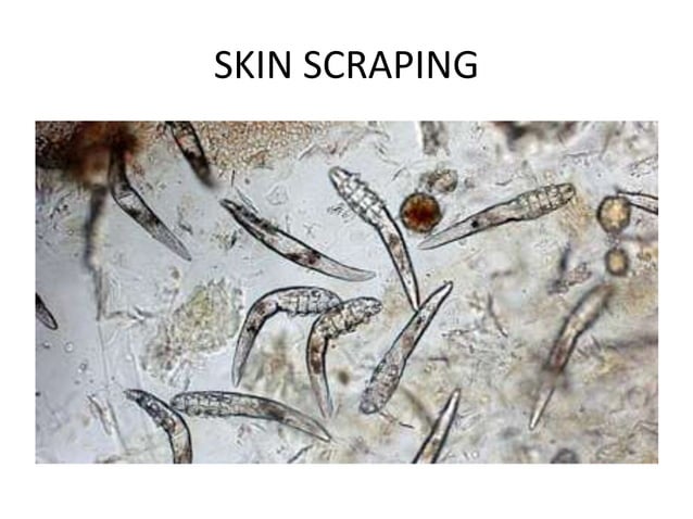 Demodex by aseem | PPTX