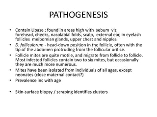 Demodex by aseem | PPTX