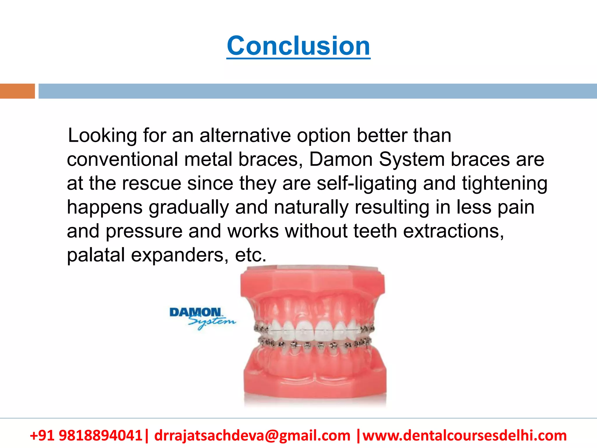 Demon braces| Ortho-dontic Treatment| Ortho-dontic Braces | PPT