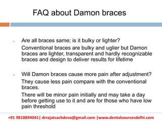 Demon braces| Ortho-dontic Treatment| Ortho-dontic Braces | PPT