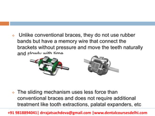 Demon braces| Ortho-dontic Treatment| Ortho-dontic Braces | PPT
