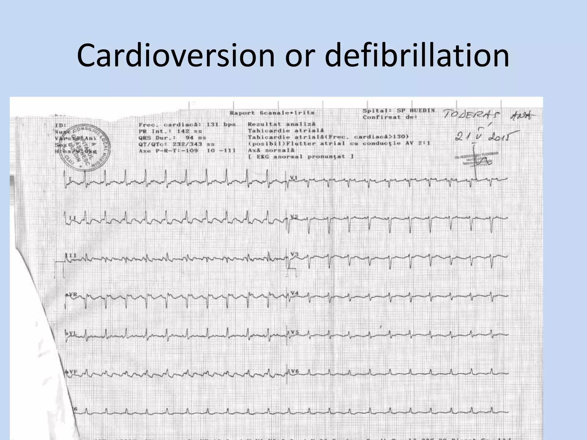 Cardioversion and Defibrillation | PPTX