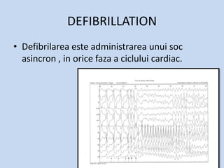 Cardioversion and Defibrillation | PPTX