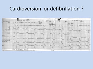 Cardioversion and Defibrillation | PPTX