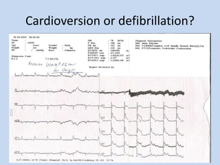 Cardioversion and Defibrillation | PPTX