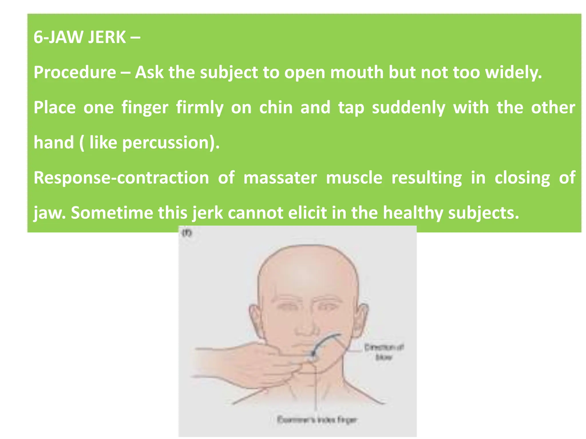 DEMONSTRATION- reflex.ppt