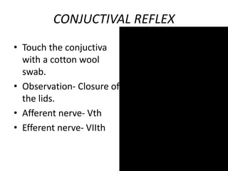 DEMONSTRATION- reflex.ppt