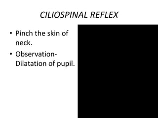 DEMONSTRATION- reflex.ppt