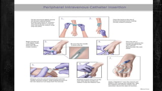 Demonstration of central line insertion | PPTX