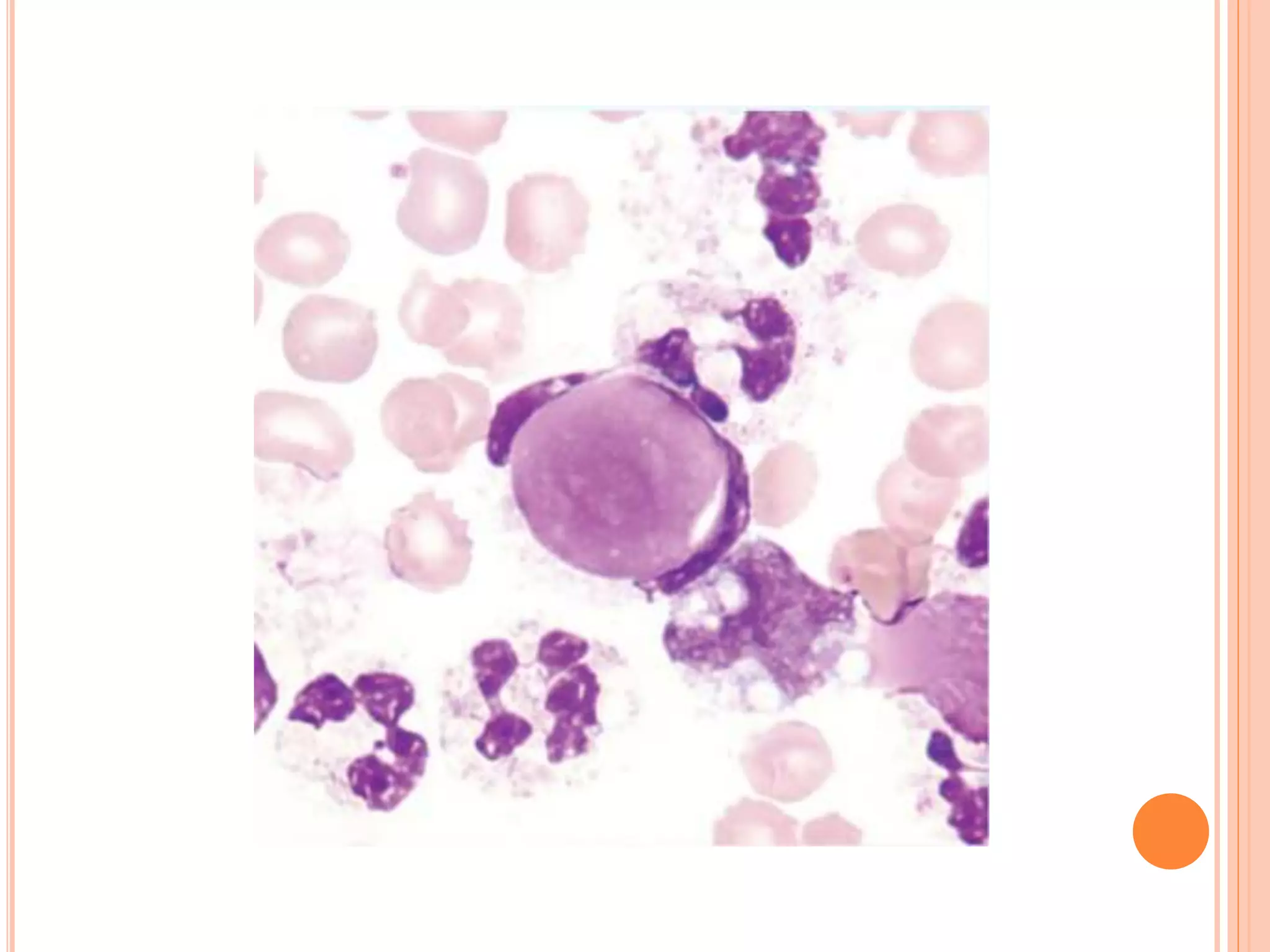 Demonstration of le cells | PPTX