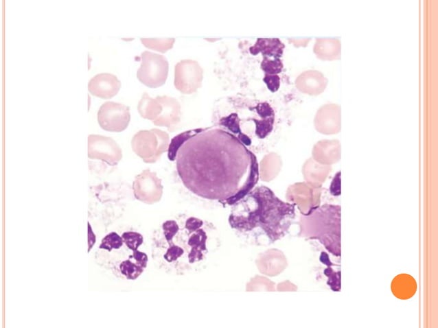 Demonstration of le cells | PPTX
