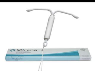 DEMONSTRATION ON IUD INSERTION.pptx