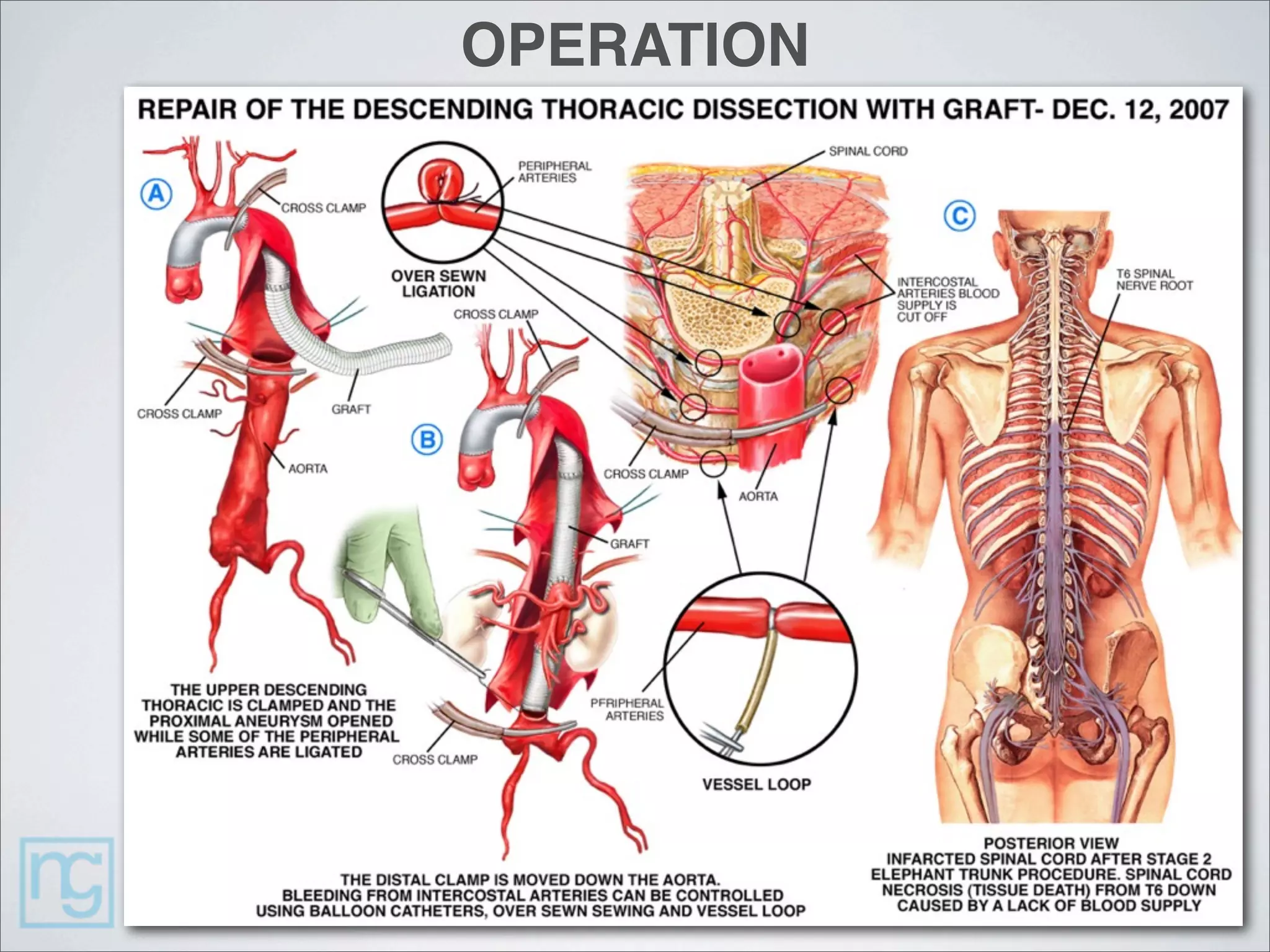 Demonstrative Evidence For Personal Injury Cases | PDF