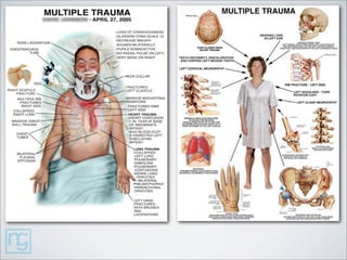 Demonstrative Evidence For Personal Injury Cases | PDF