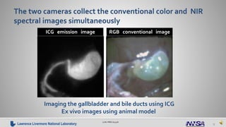 Guided Surgery using Endoscopic Multimodal Imaging by Stavros Demos | PPTX