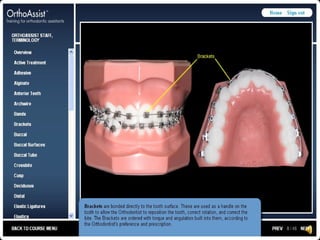 Ortho Assist Demo | PPT