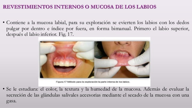 Demostración y exploración de la cavidad oral. Luis Alberto Reyes Dom…