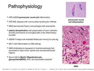 Demyelinating disorders approach | PPTX