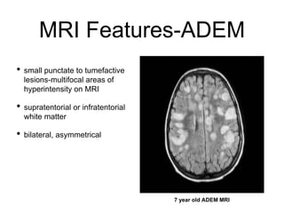 Demyelinating disorders approach | PPTX