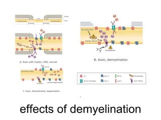 Demyelinating disorders approach | PPTX