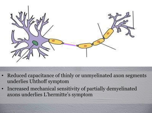 Pathology of Demyelinating Disease | PPT