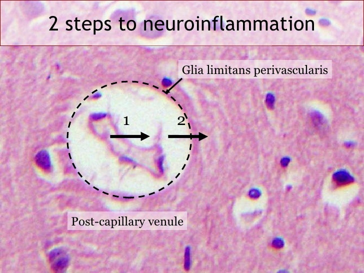 Pathology of Demyelinating Disease