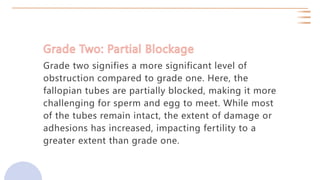 Demystifying Fallopian Tube Blockage- Grading the Differences and ...
