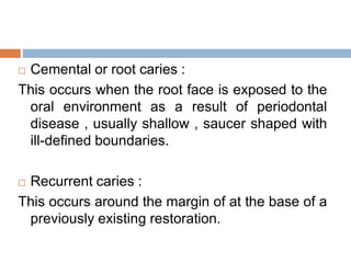 Denatal caries - Tooth decay | PPTX