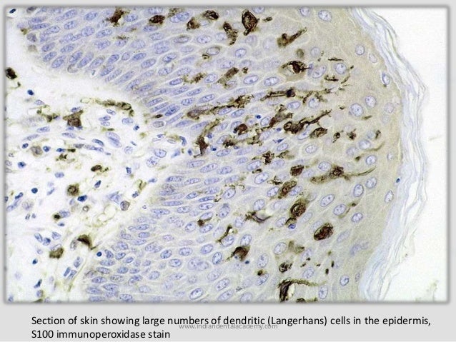 Dendritic cells biology of the skin