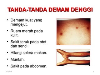 Penyakit Demam Denggi. Pengenalan dan Kawalan. | PPT