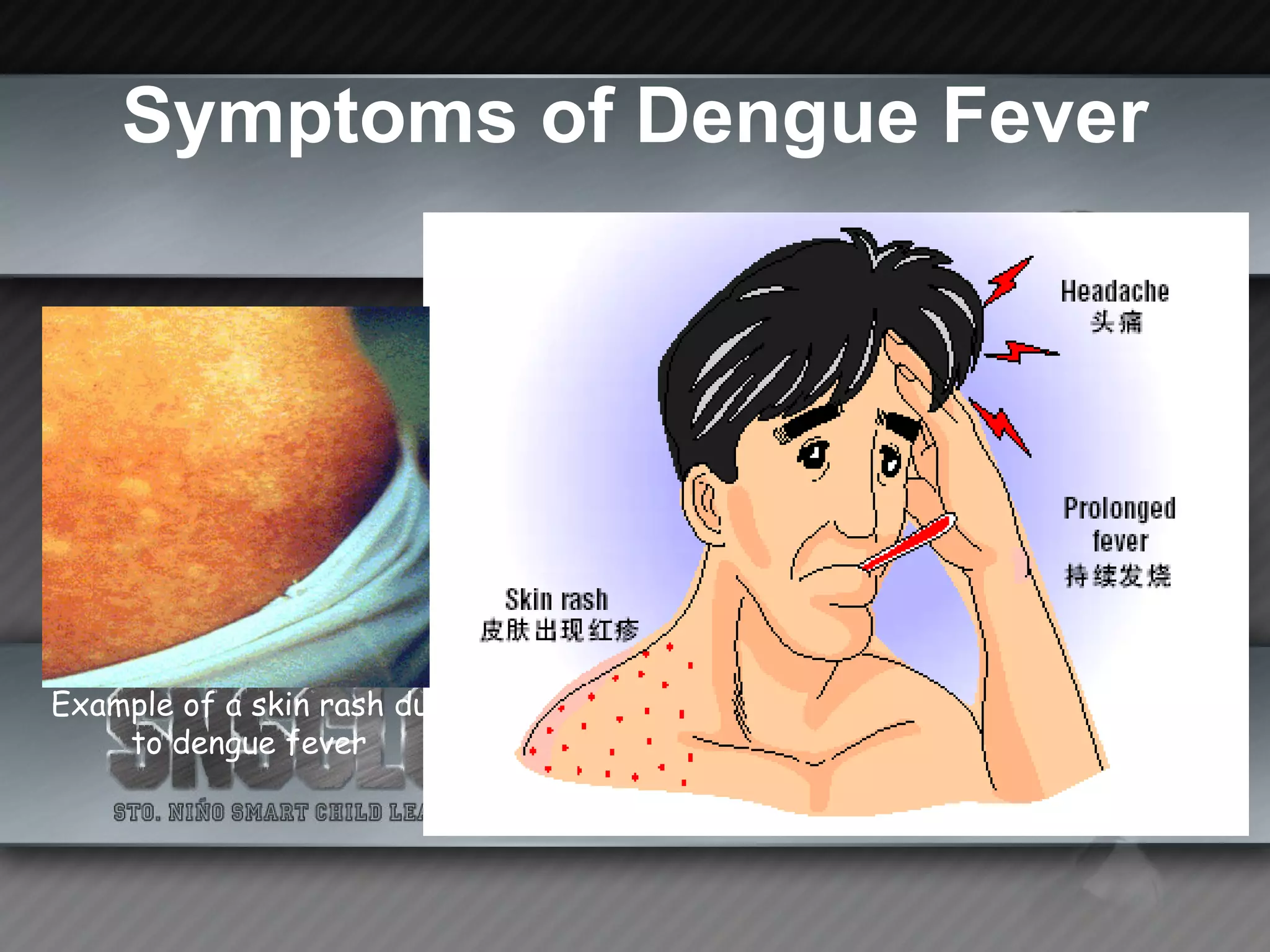 Dengue | PPT