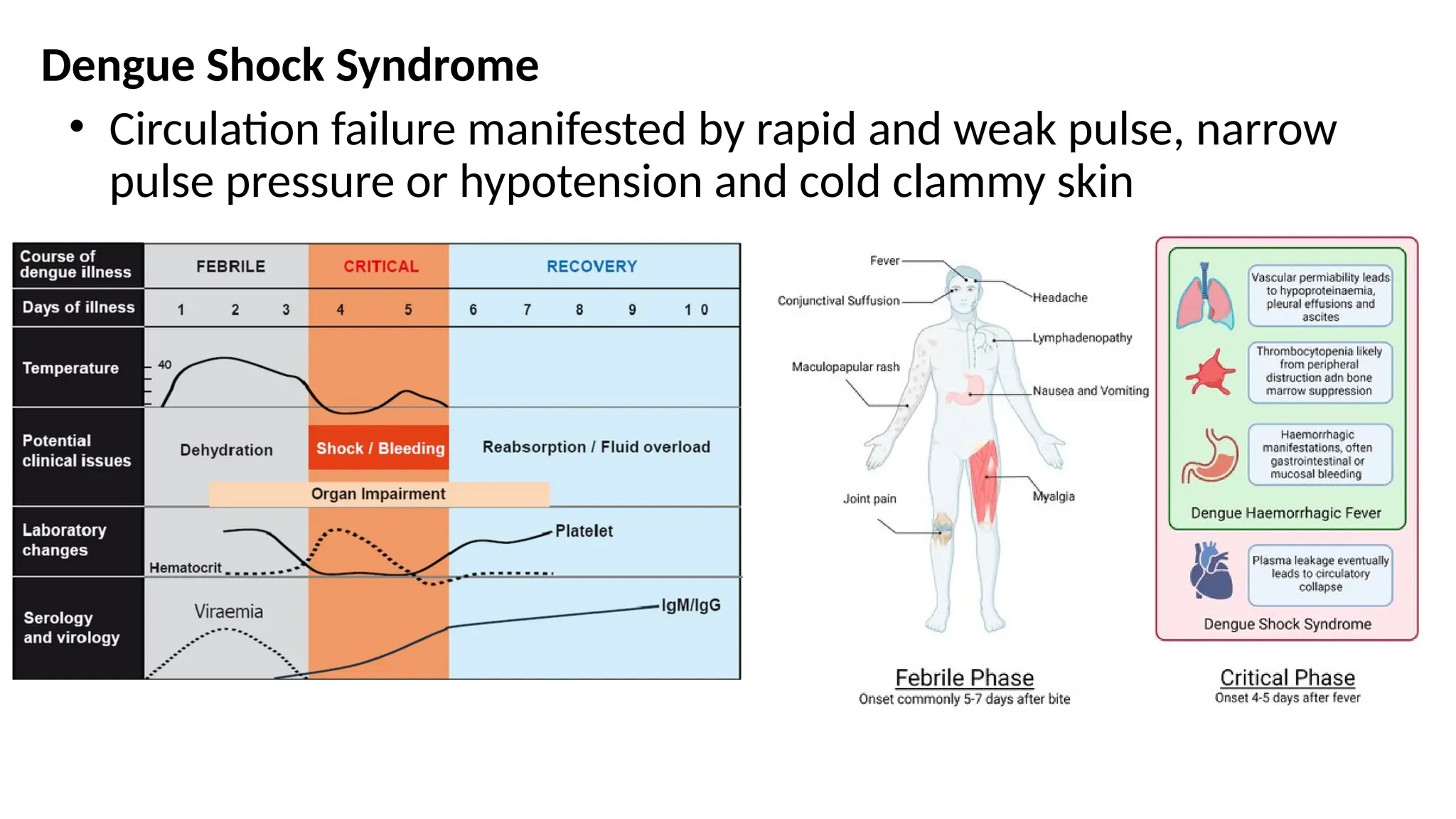 Dengue fever, Dengue Hemorrhagic Fever, Dengue Shock Syndrome | PPTX