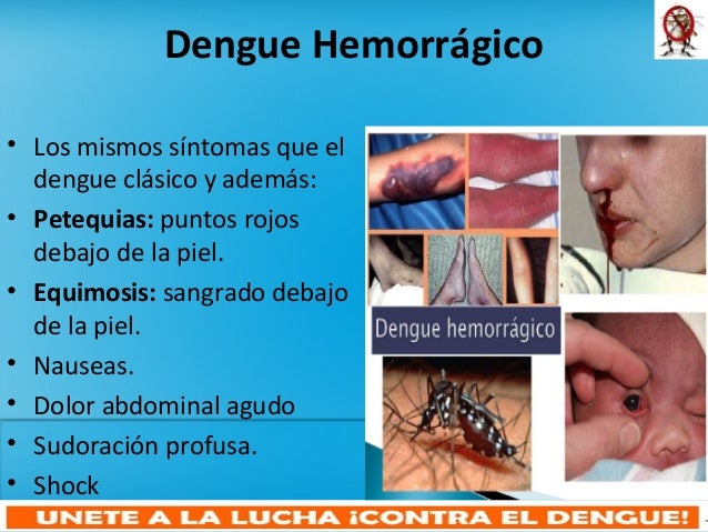 Dengue