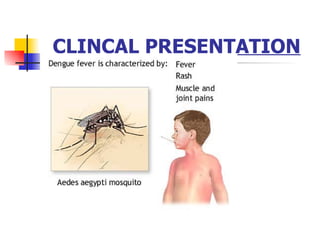 DENGUE FEVER | PPT