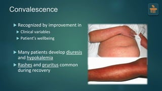 Dengue Fever - Rational Management | PPT