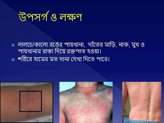 Dengue Fever awareness in Bangla | PPTX