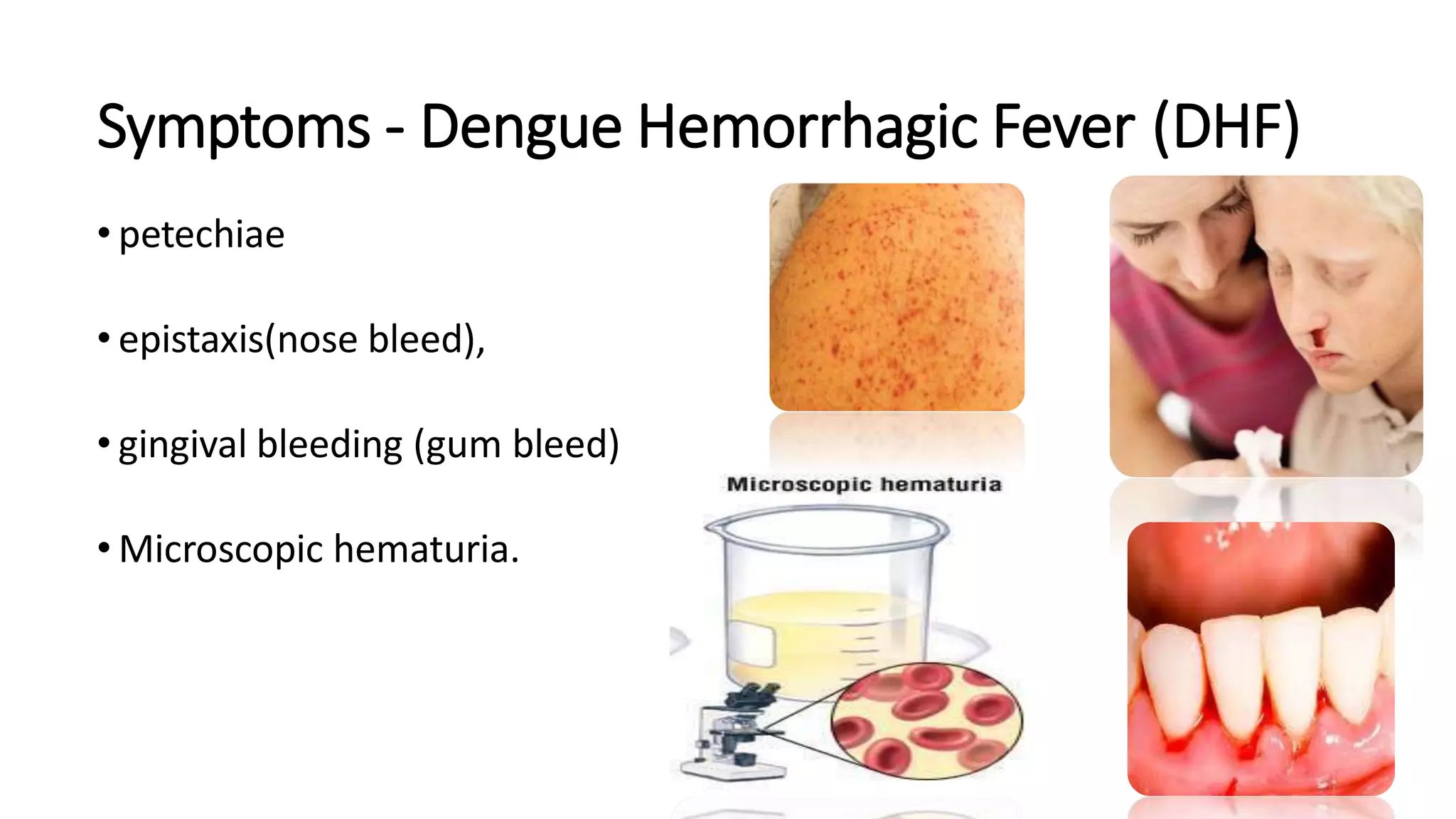 Dengue, dengue hemorrhagic fever, dengue shock syndrome | PPTX