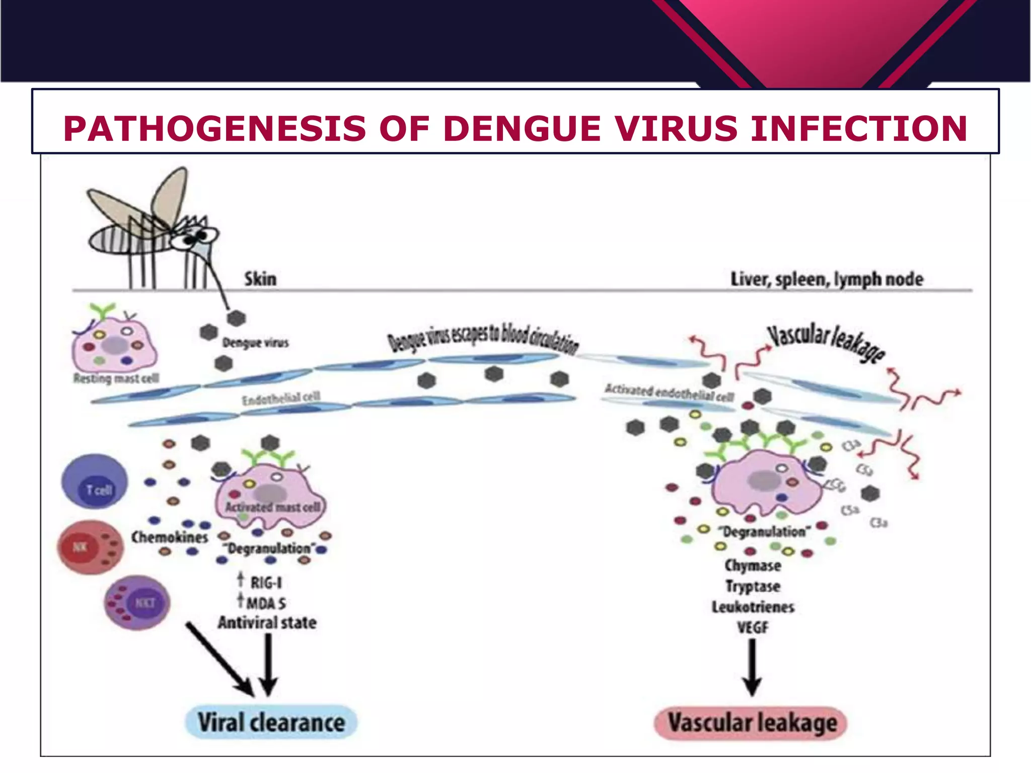 Dengue fever | PPT