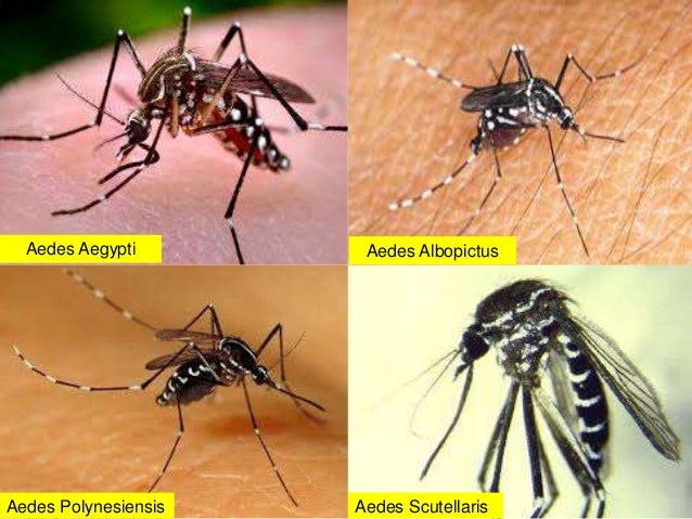 Dengue or Break-Bone Fever