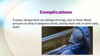 Dengue fever- a medical study ( definition, management ,prevention ...