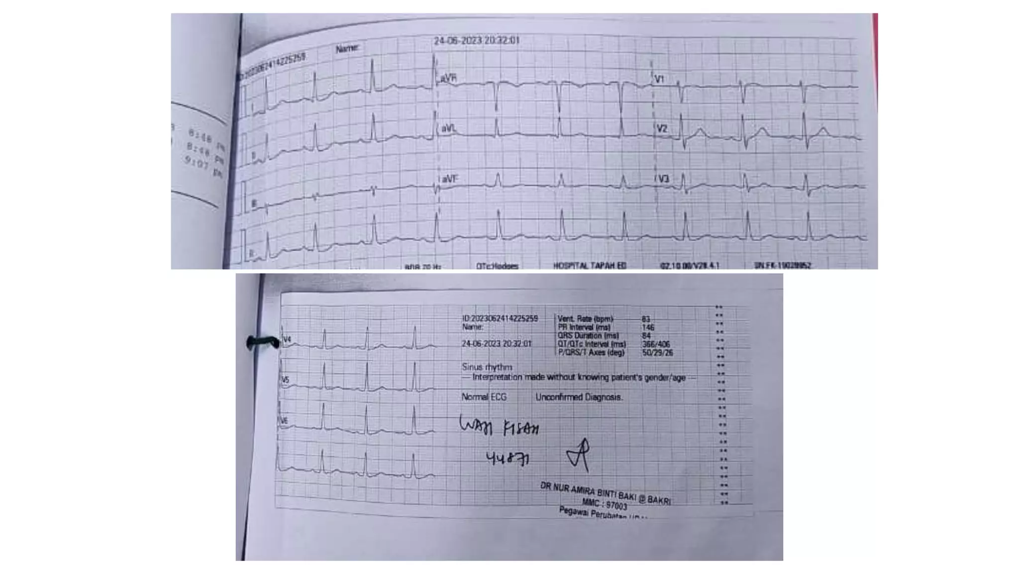 DENGUE FEVER RESUS ED.pptx