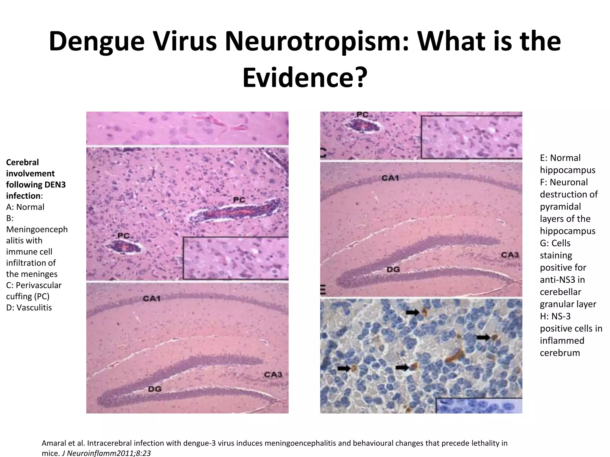 dengue fever management | PPTX