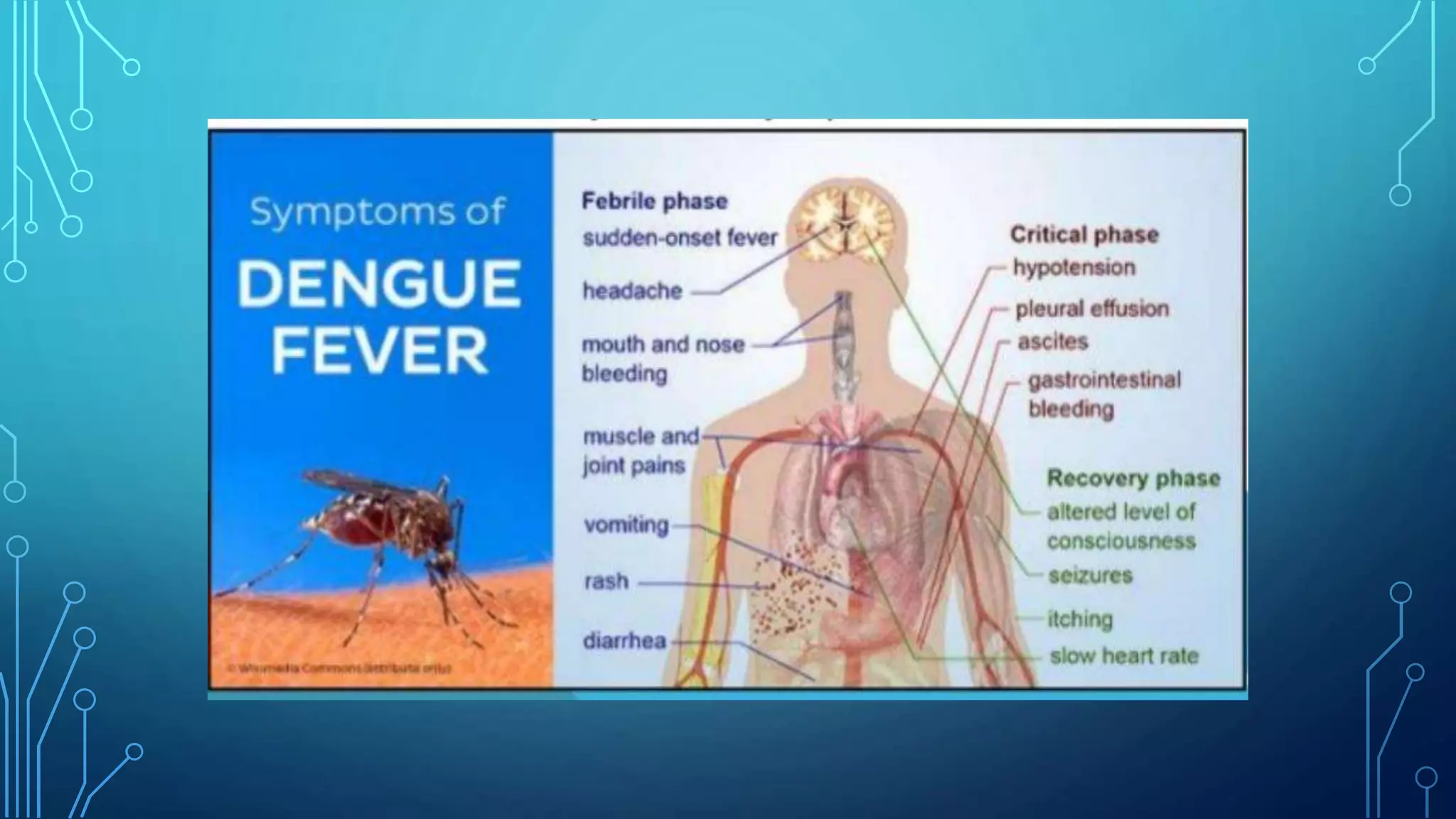 Dengue Causes and its Symptoms- School Project | PPTX