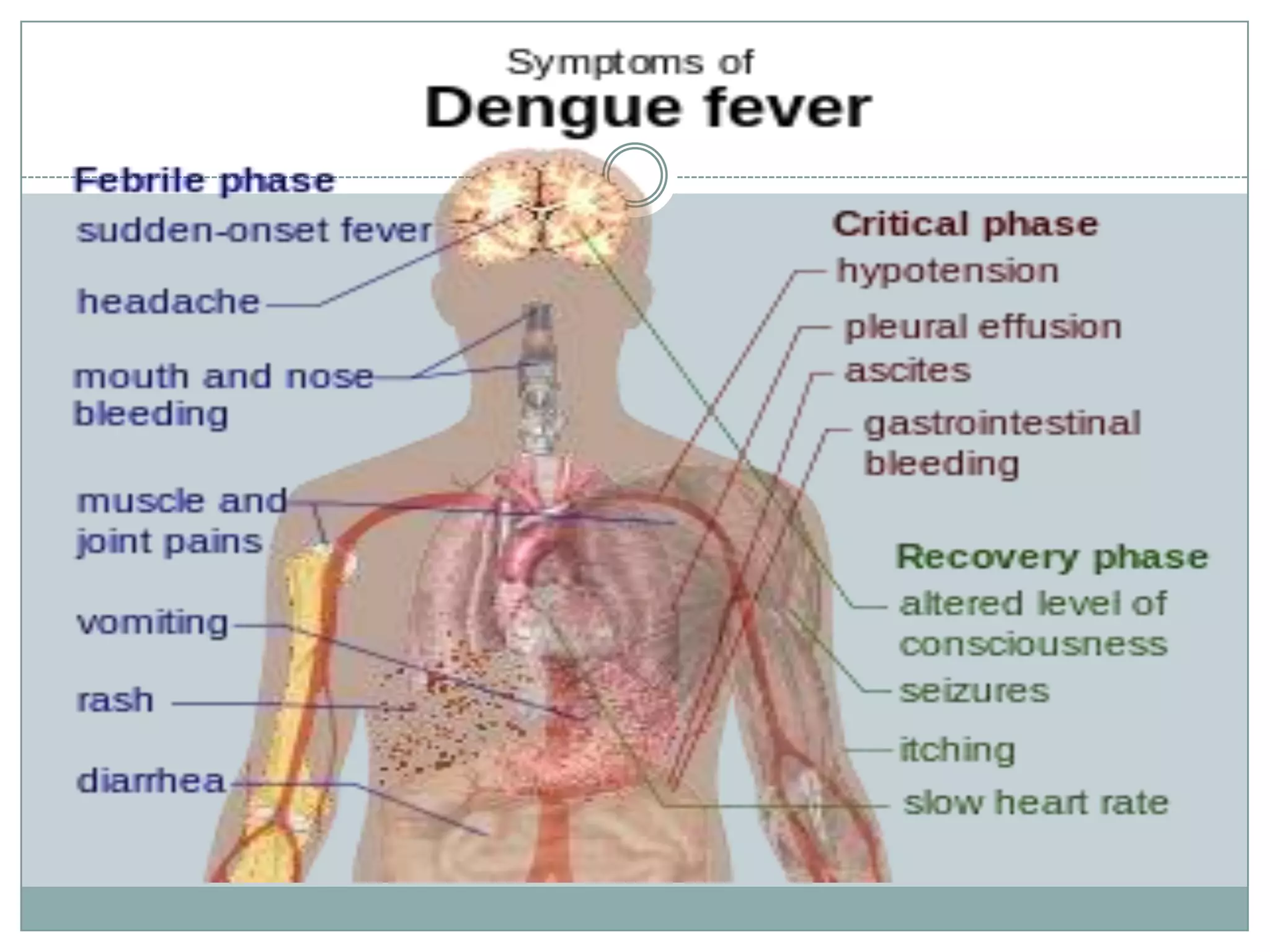 Dengue fever presentation | PPTX