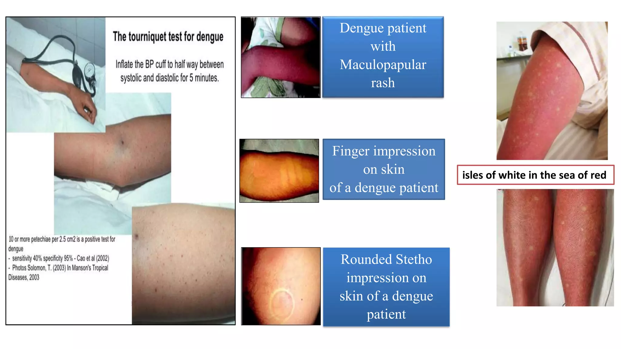 Dengue_Presentation3_(final).pdf